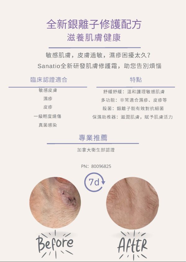 Santo Skin Relief Cream - MDD HK